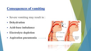 Antiemetics, Pharmacology by Baqir Naqvi.pptx