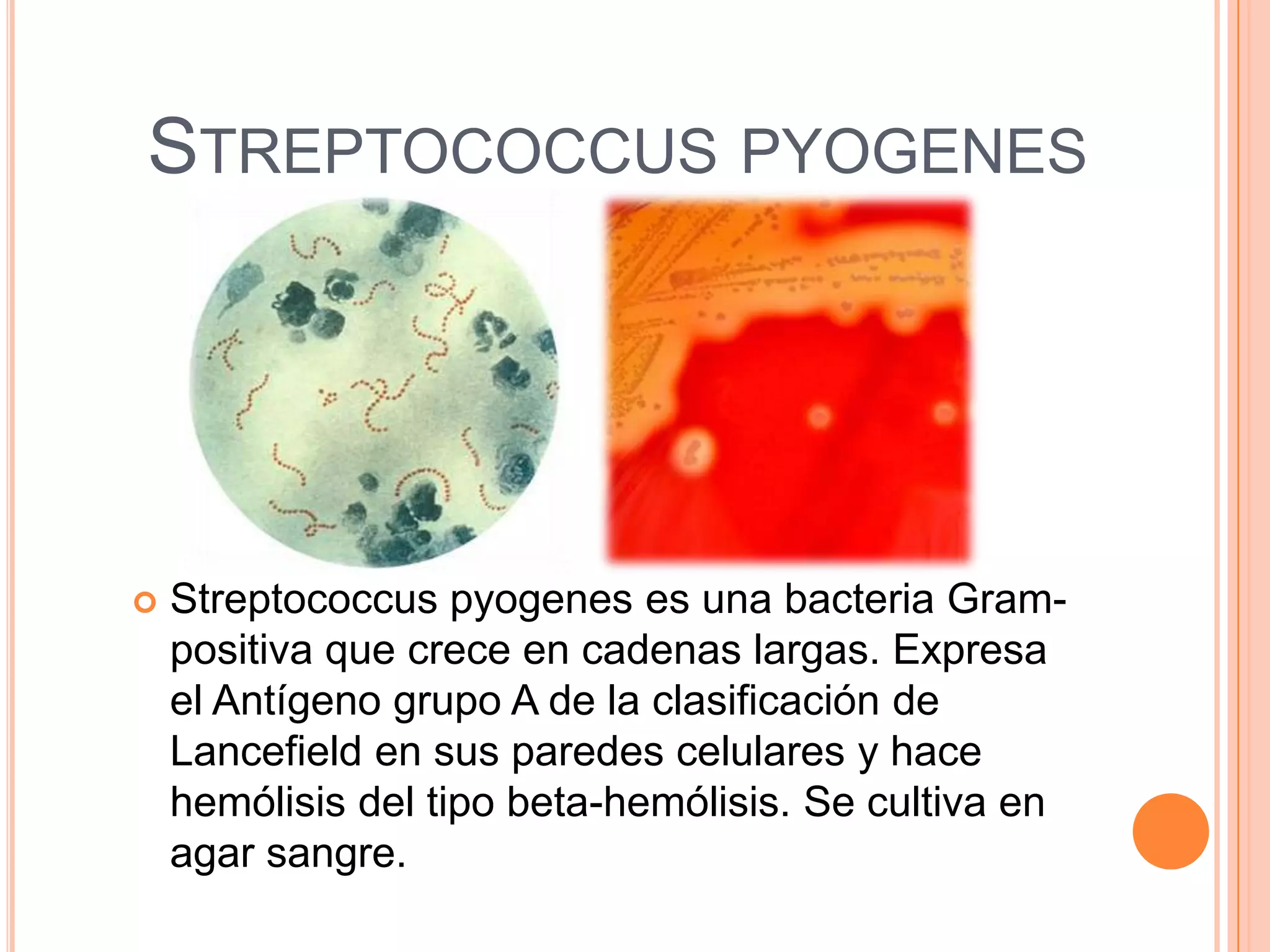 Antiestreptolisinas aslo | PPTX