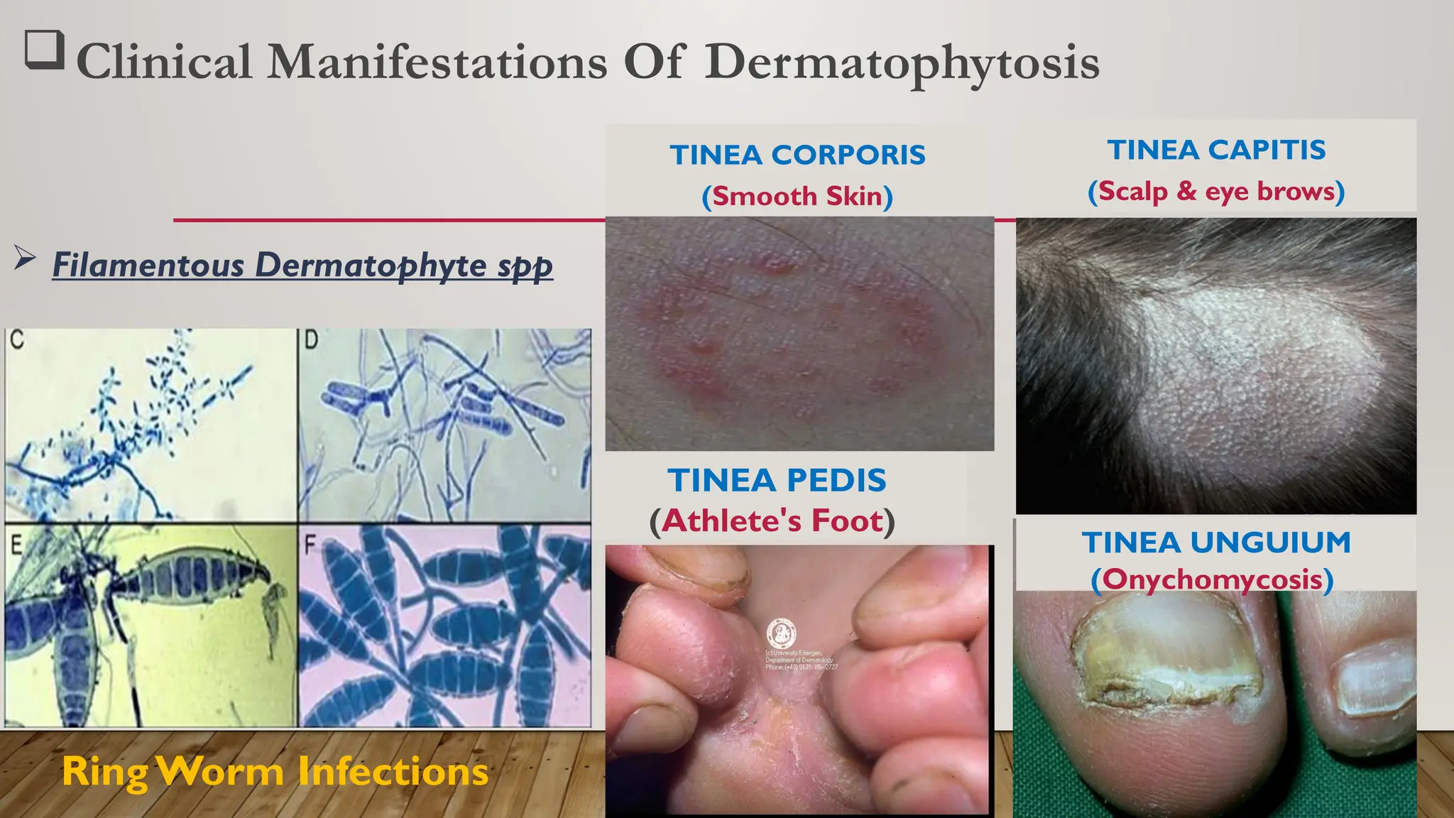 Antifingal mechanism of action and resistance.pptx