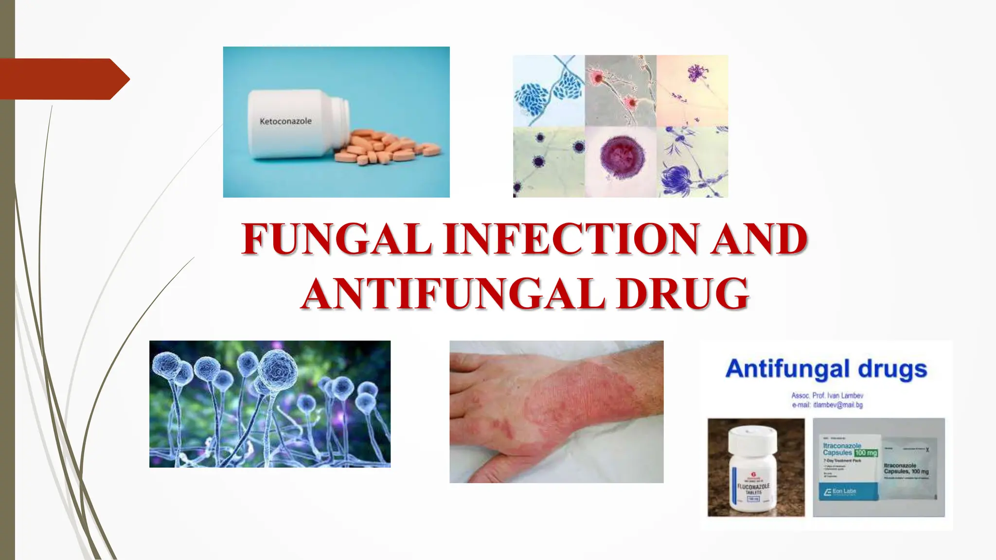 ANTIFUNGAL AND ANTI-TUBERCULOSIS DRUGS WITH CLASSIFICATION | PPTX
