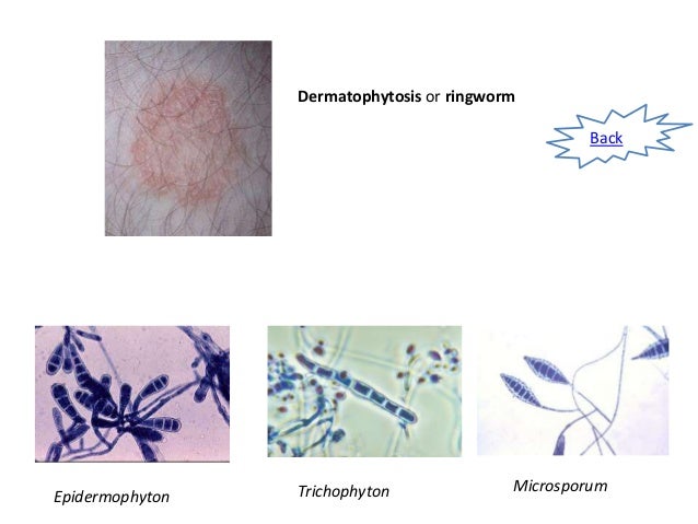 Antifungal drugs-Antibiotics