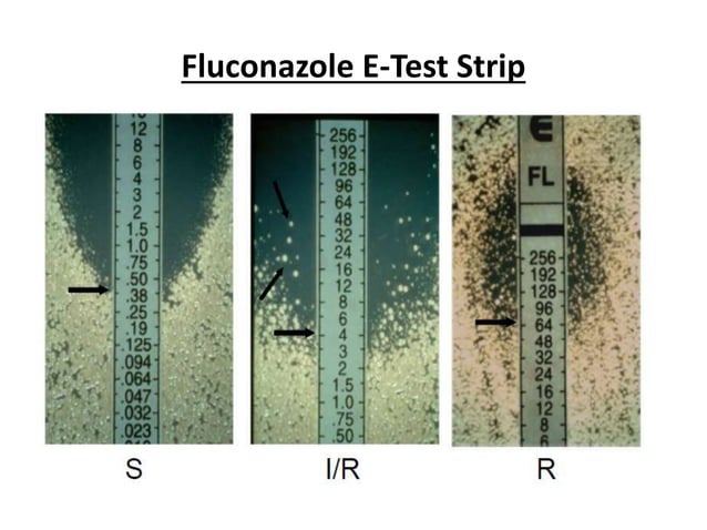 Antifungal Susceptibility Test | PPTX