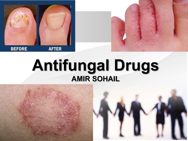 Antifungals drugs classification,mechanism of action uses and adverse ...