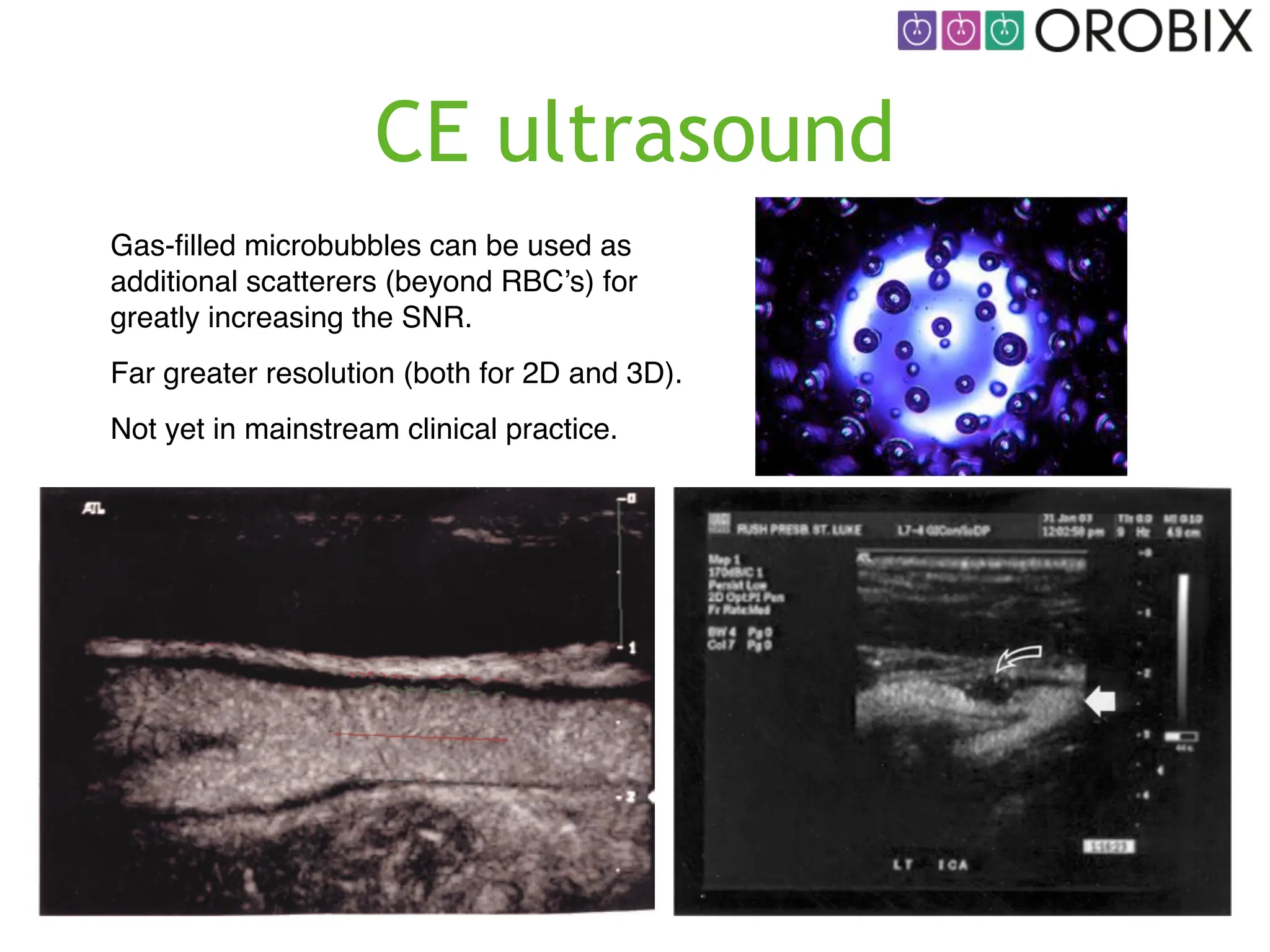 Brain MRI advances on elastography and 4dflow techniques | PDF