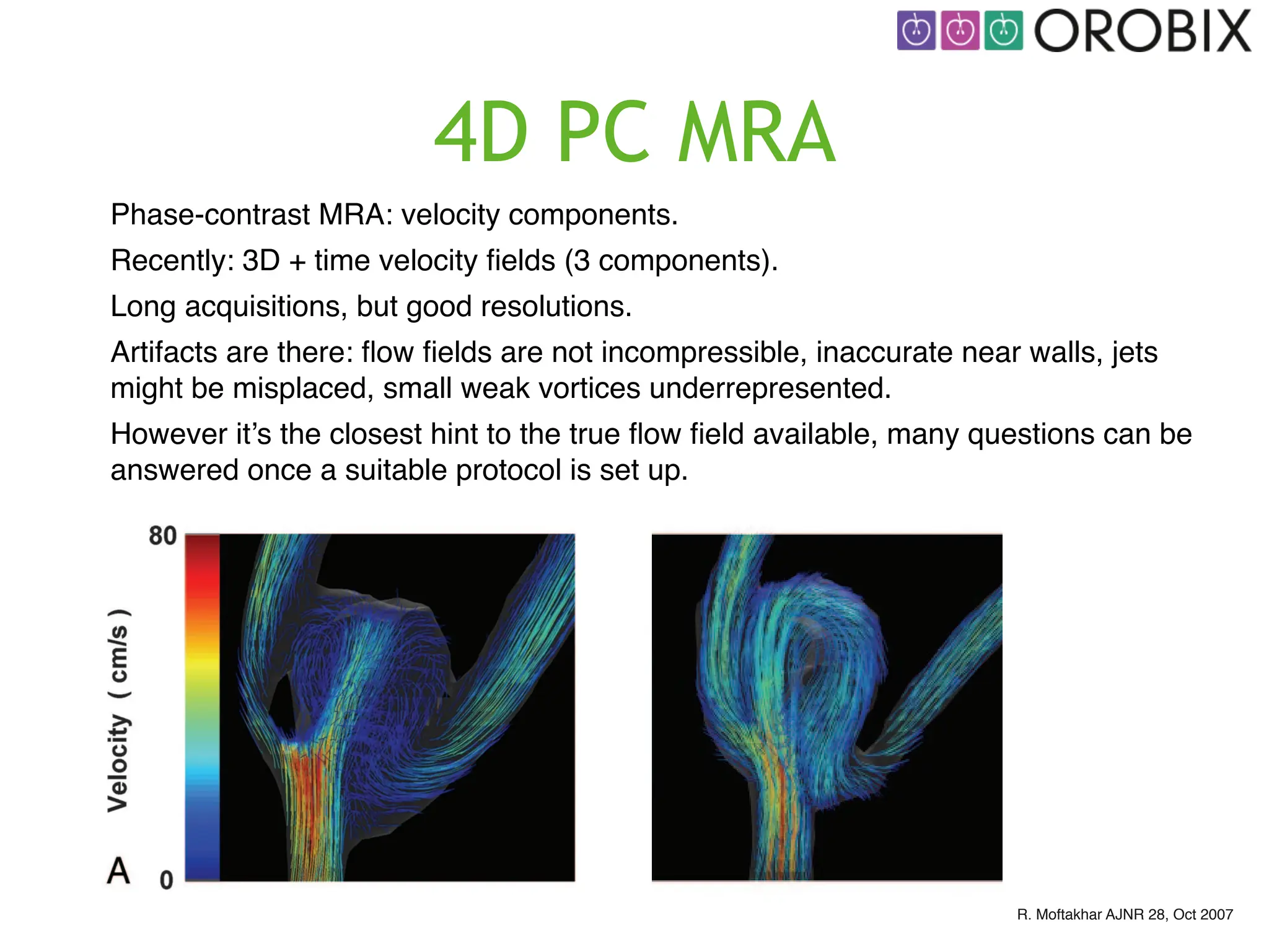 Brain MRI advances on elastography and 4dflow techniques | PDF