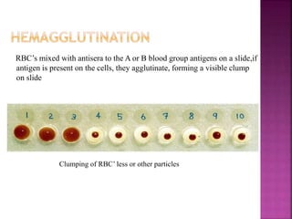 Antigen antibody interaction | PPSX