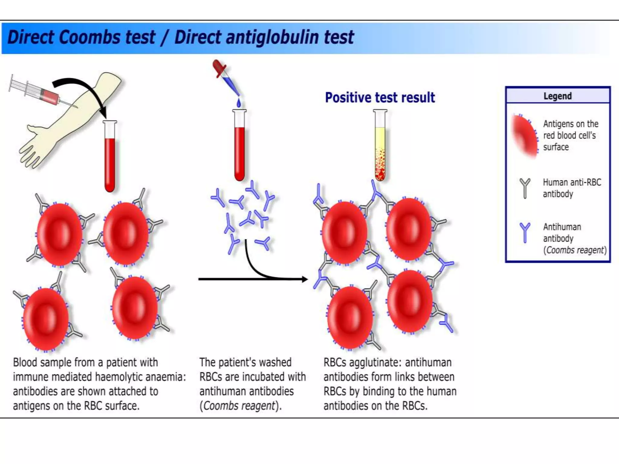 Antigen-Antibody Reaction..pptx