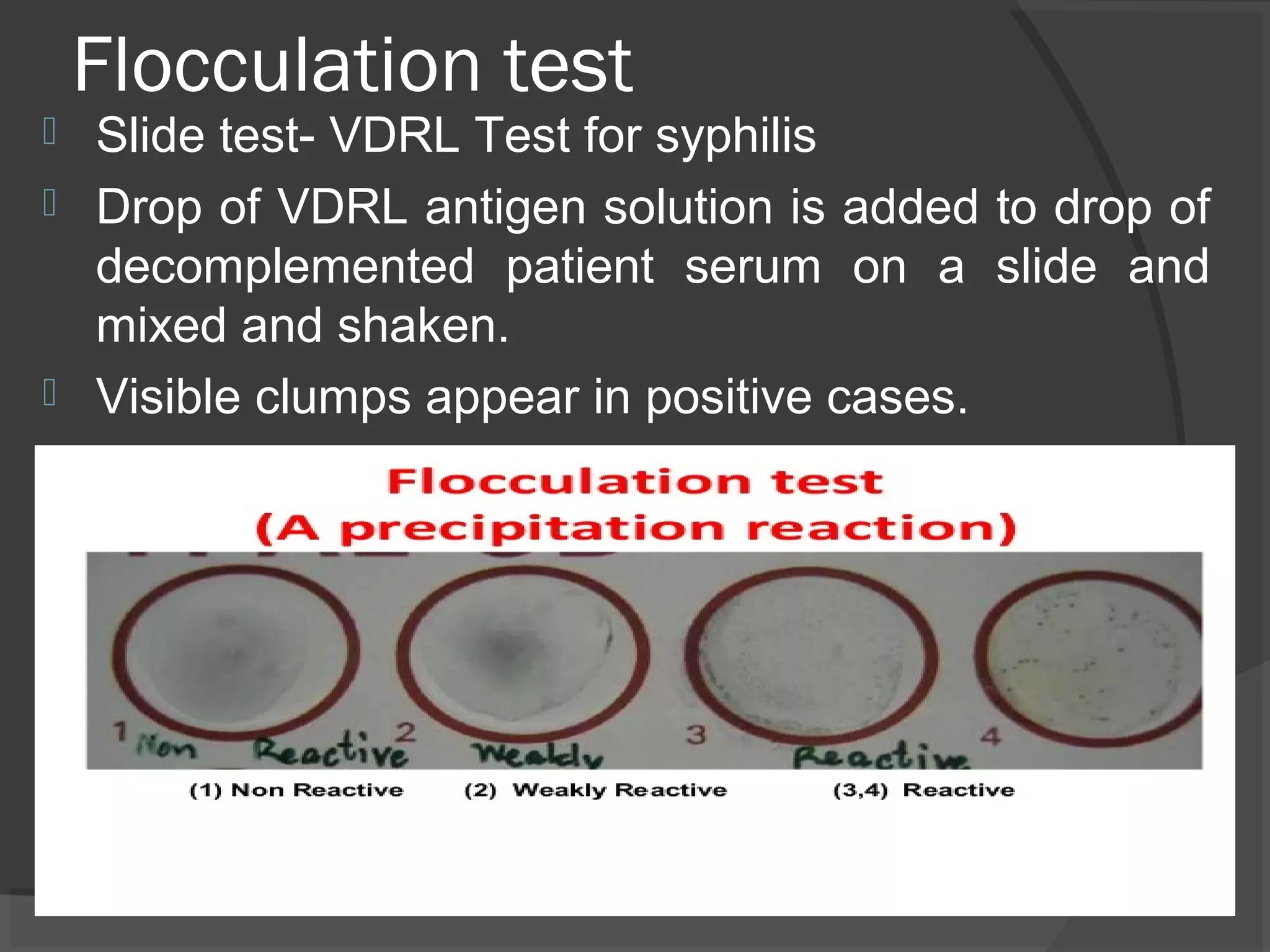 Antigen antibody reactions | PPT