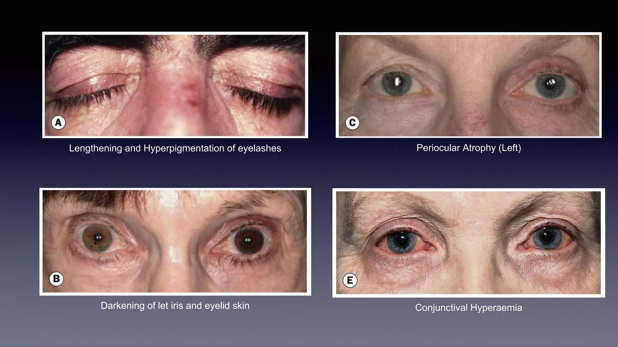 ANTIGLAUCOMA DRUGS by DR. ZAW MIN HTET | PPTX