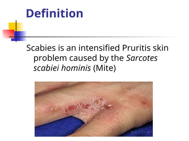 ANTI HELMINTTH AND ANTI SCABIES DRUGS.ppt