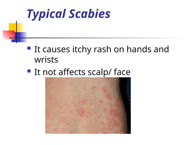 ANTI HELMINTTH AND ANTI SCABIES DRUGS.ppt