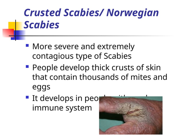 ANTI HELMINTTH AND ANTI SCABIES DRUGS.ppt