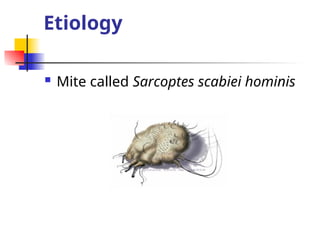 ANTI HELMINTTH AND ANTI SCABIES DRUGS.ppt