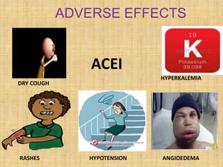 ANTIHYPERTENSIVES - moa , uses , adv effects | PPT