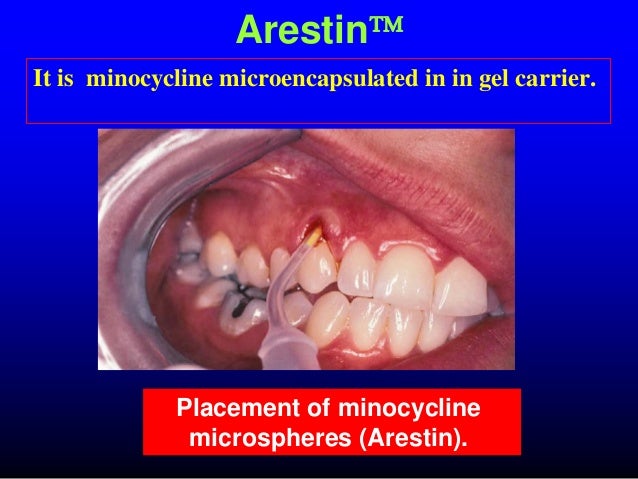 Antiinfective host modulation dr alaa