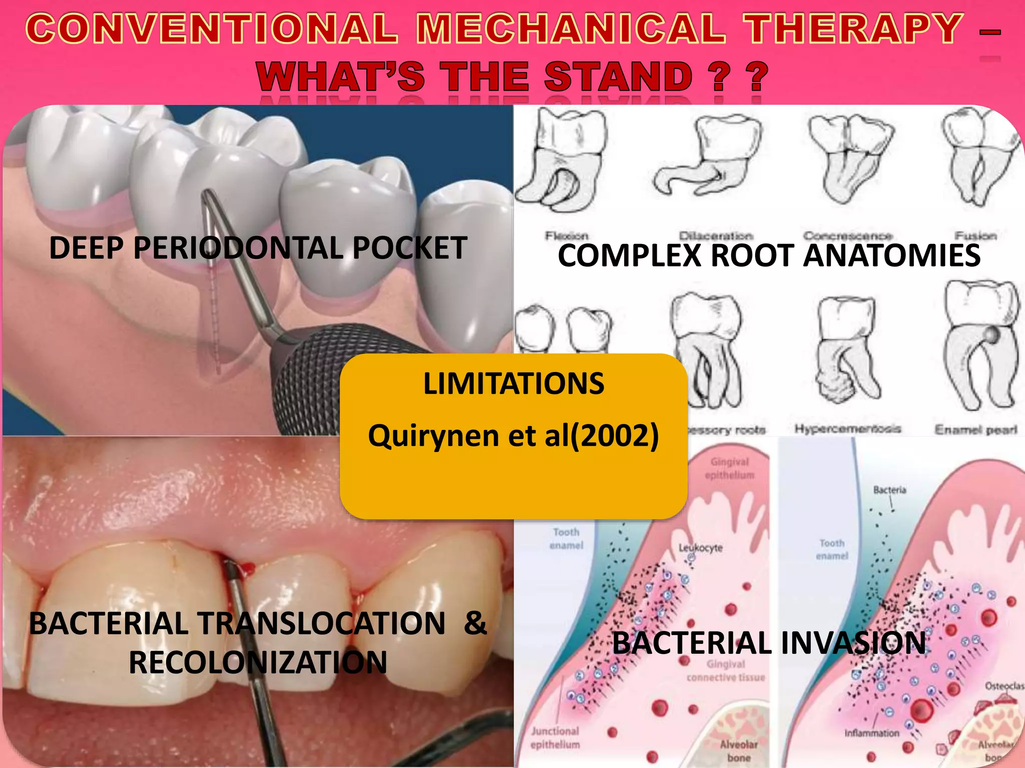 Antiinfective therapy in periodontics | PPTX