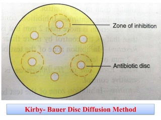 Antimicrobial sensitivity test | PPTX