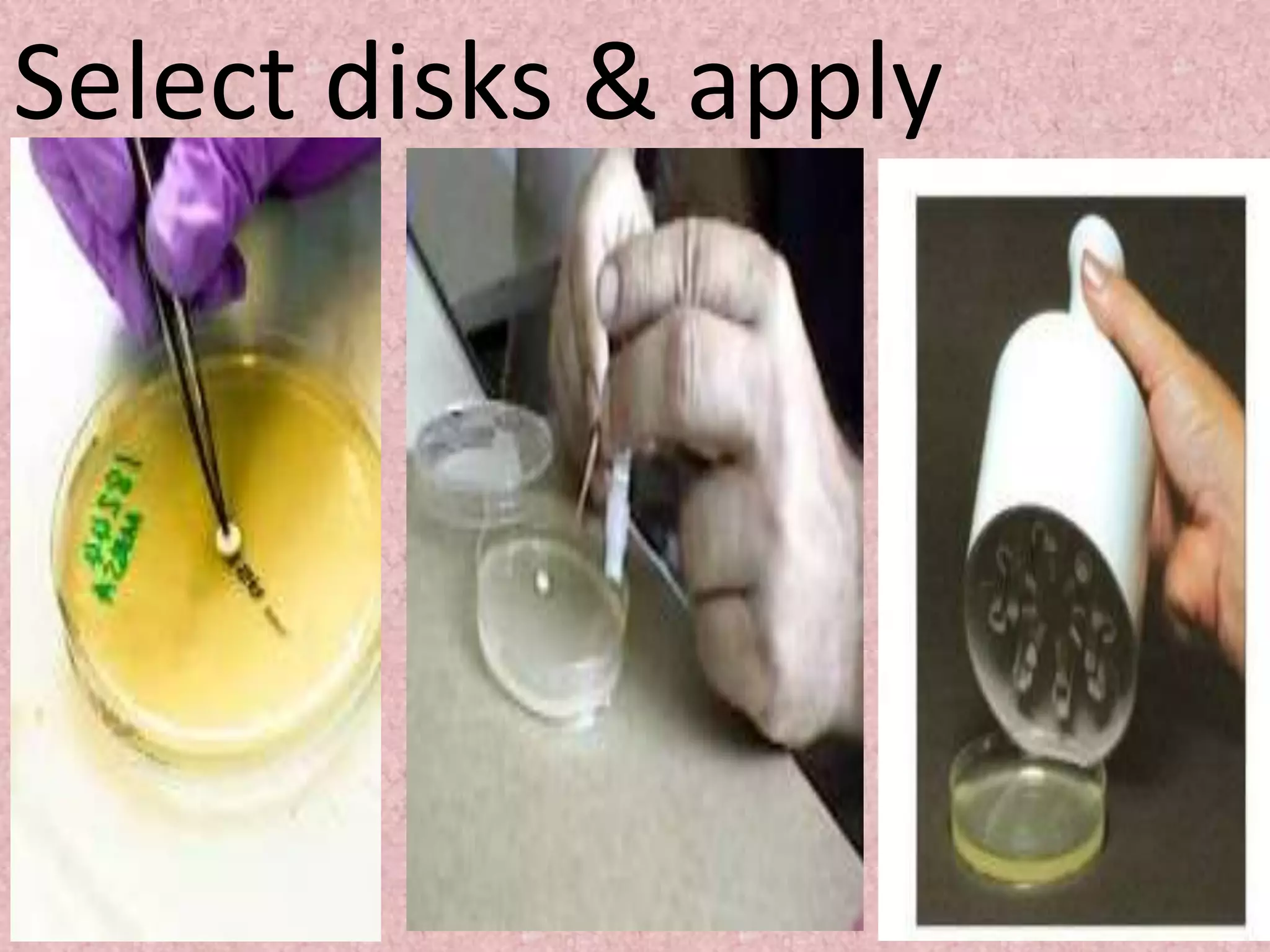 Anti microbial susceptibility testing | PPTX