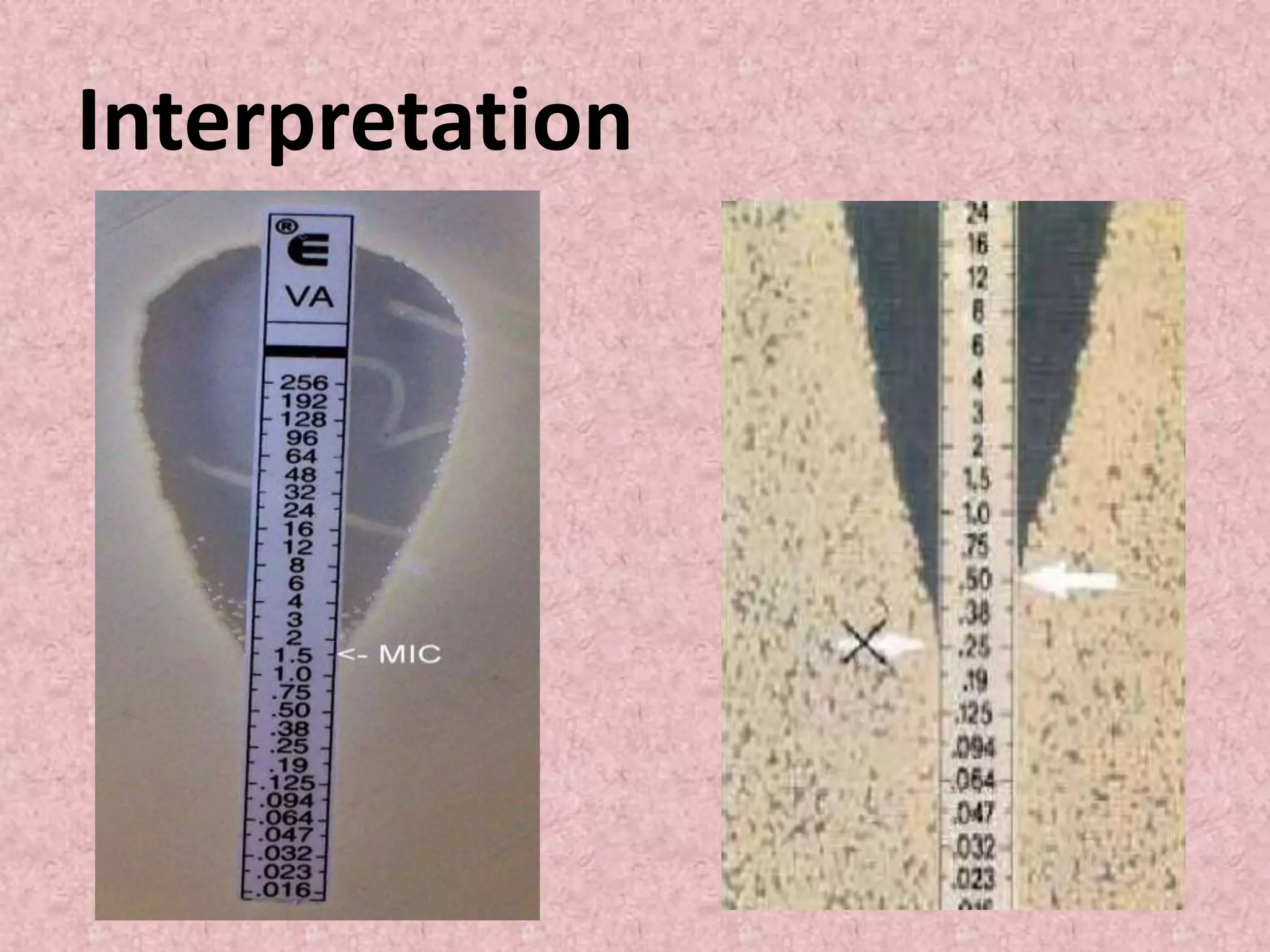 Anti microbial susceptibility testing | PPTX