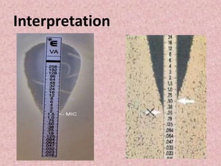 Anti microbial susceptibility testing | PPTX