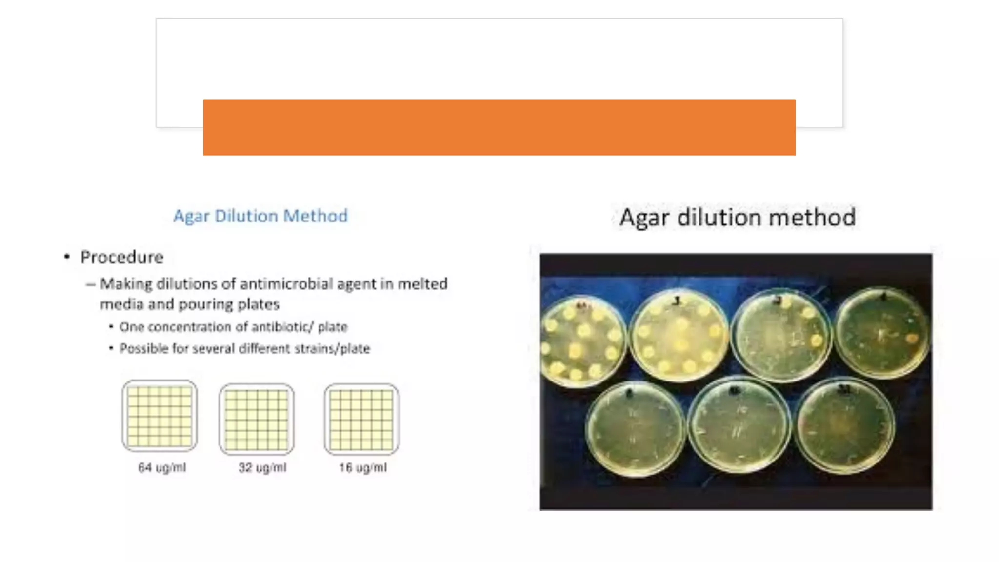 Antimicrobial susceptibility testing- Microbiology | PDF