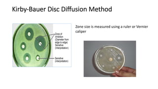 Antimicrobial susceptibility testing- Microbiology | PDF