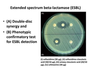 Antimicrobial susceptibility testing | PPTX