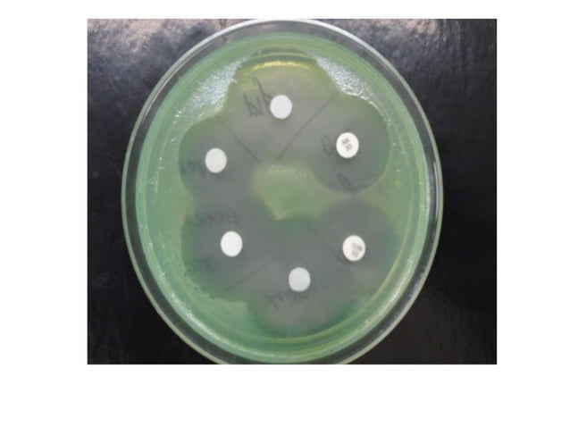 Antimicrobial susceptibility testing – disk diffusion methods | PPTX ...
