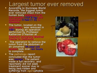 Antineoplastic agents(ravisankar) | PPT