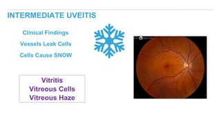Uveitis: Clinical Features & Investigations | PDF