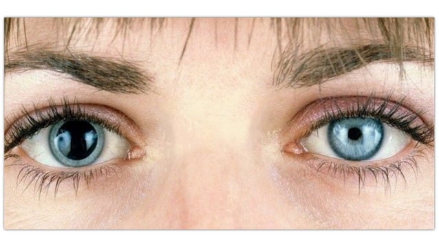 Uveitis: Clinical Features & Investigations | PDF | Eye and Vision ...