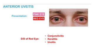 Uveitis: Clinical Features & Investigations | PDF