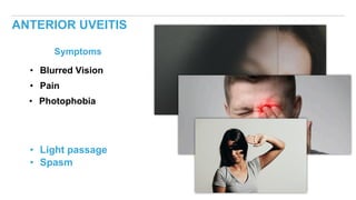 Uveitis: Clinical Features & Investigations | PDF