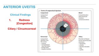 Uveitis: Clinical Features & Investigations | PDF