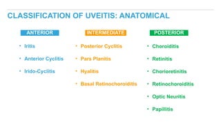 Ant Int Post Uveitis Ant Int Post Uveitis | PPT