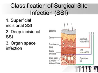 Antiobiotic prophylaxis for surgical site infection | PPT