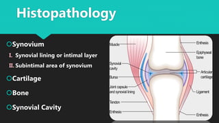 Role of Antioxidant in Rheumatoid Arthritis | PPTX
