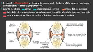 Role of Antioxidant in Rheumatoid Arthritis | PPTX