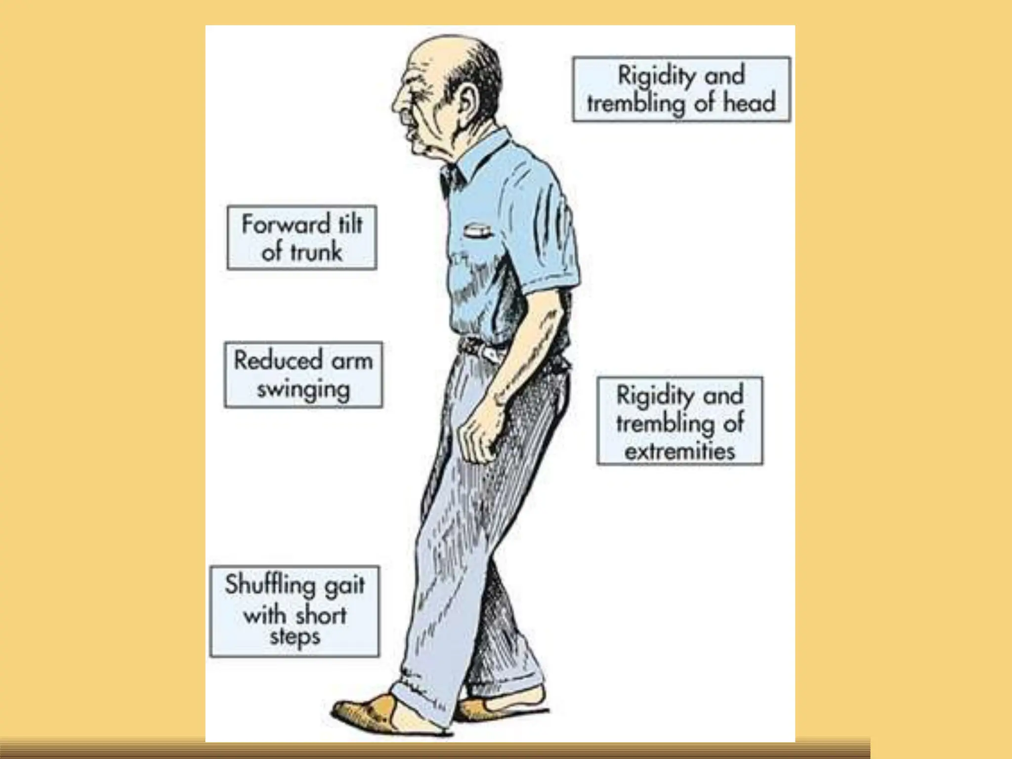 antiparkinson drug-Dopamine precursors,levodopa,cabidopa,bromocriptyne ...
