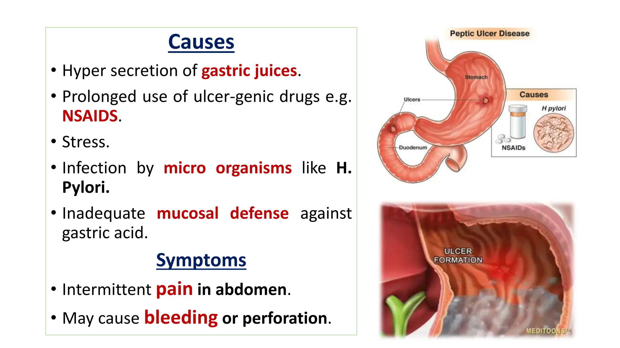 Anti peptic ulcer drugs, by Baqir Naqvi.pptx