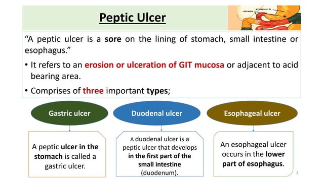 Anti peptic ulcer drugs, by Baqir Naqvi.pptx