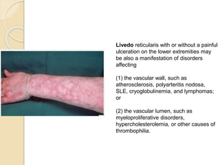 Antiphospholipid | PPTX