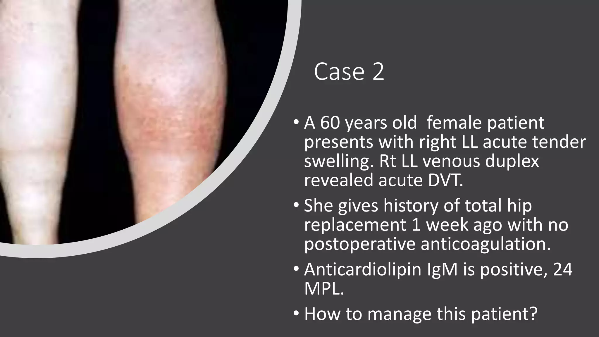 Antiphospholipid syndrome EULAR guidelines case based approach Ahmed ...