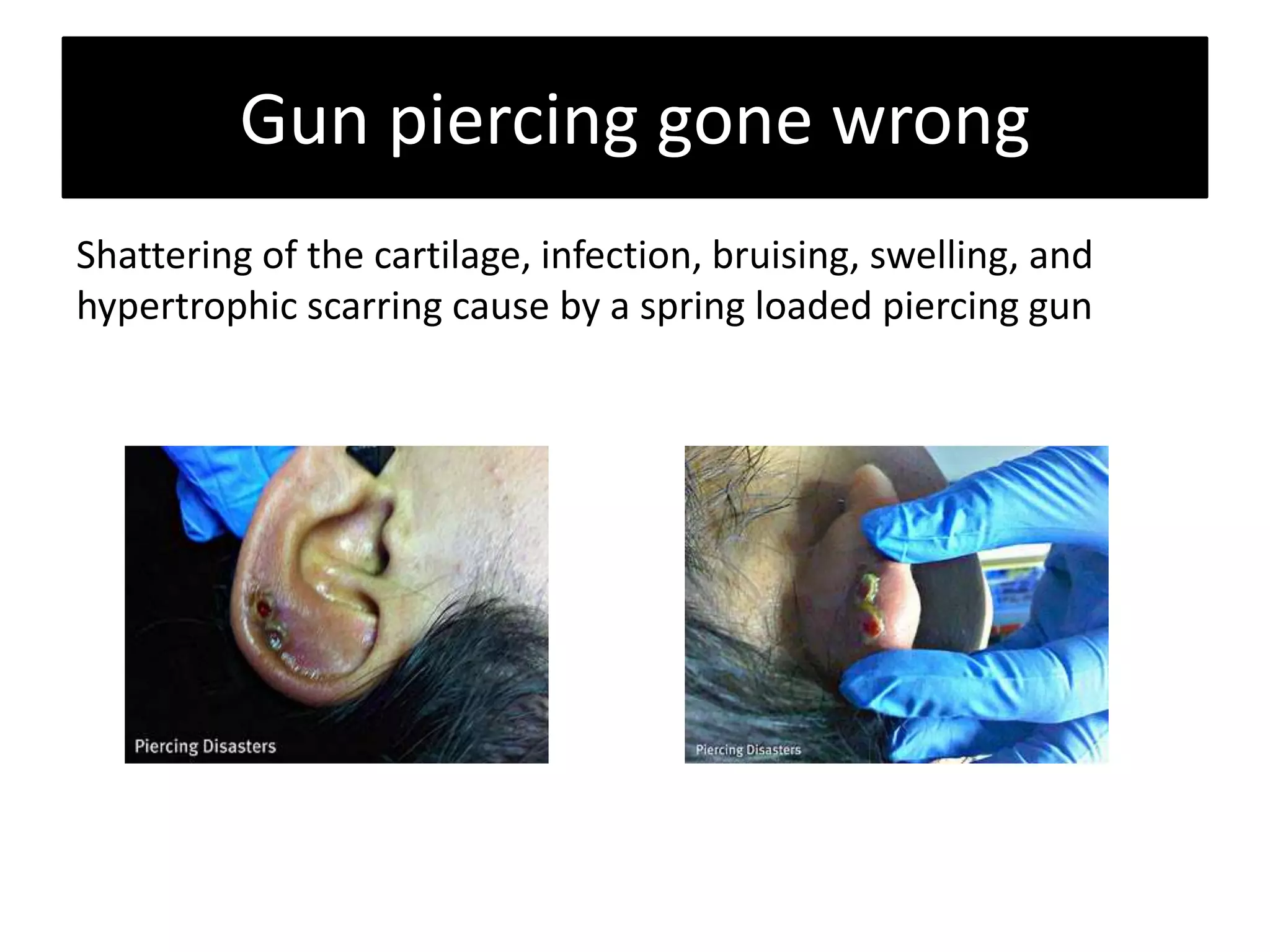 Anti piercing gun | PPTX