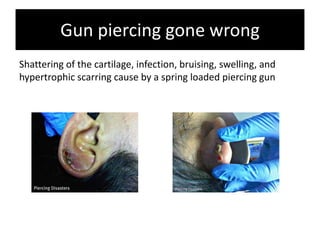 Shattered Cartilage Piercing Gun