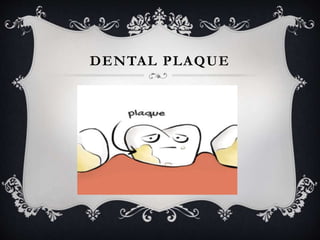 Anti plaque | PPTX