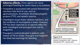 Antiplatelet anticoagulants.pptx