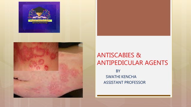 Antiscabies &antipedicular agents | PPTX | Skin and Dermatology ...