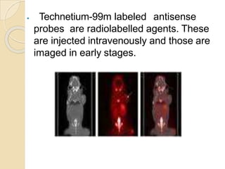 Antisense oligonucleotide therapy | PPT