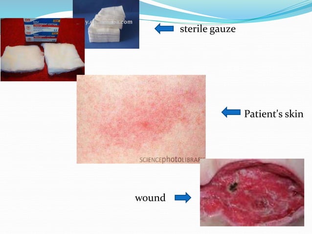 Antiseptic non touch technique (ANTT) | PPTX | First Aid | Injuries